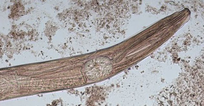 How To Get Rid of Pinworms